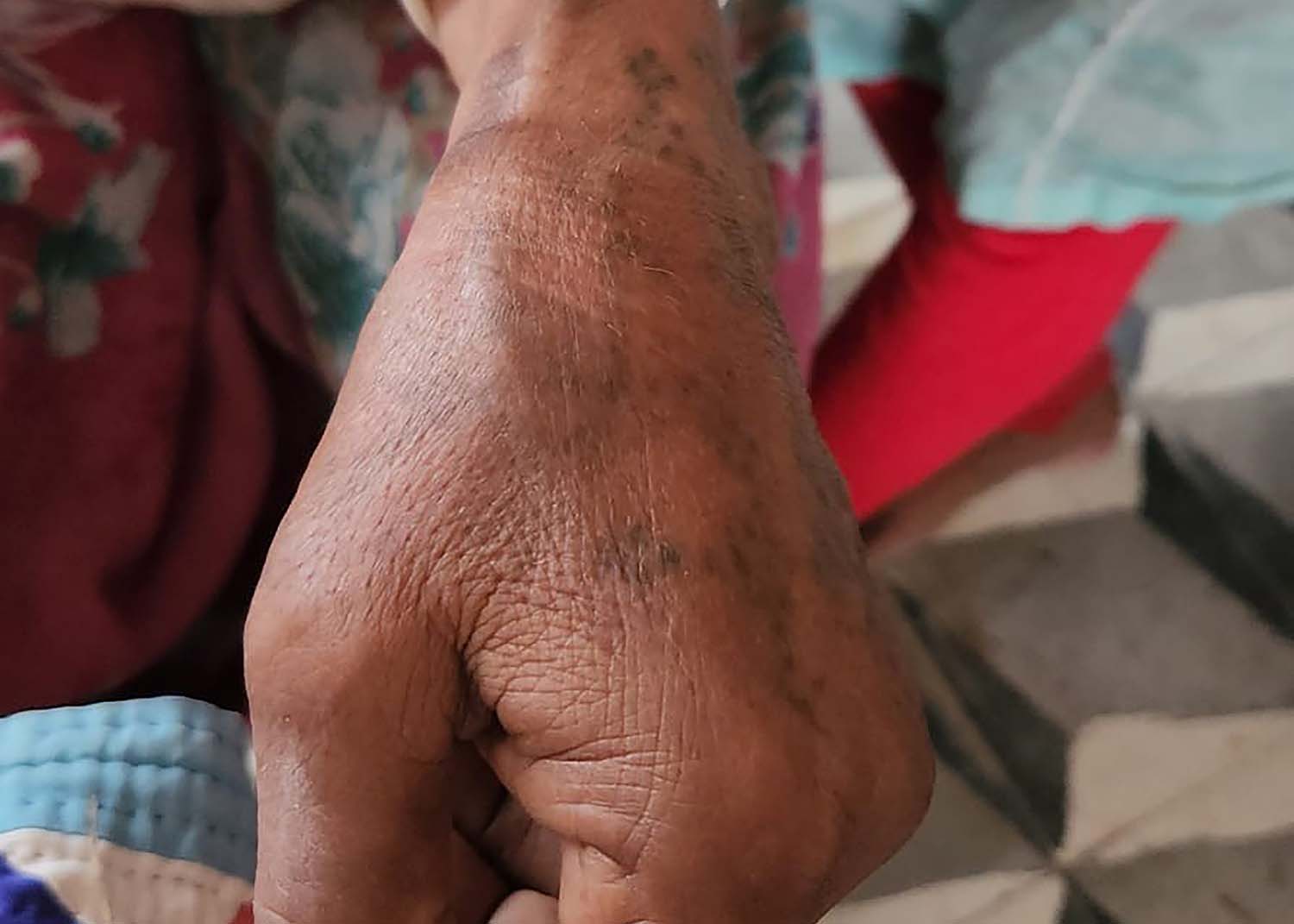 Teeto – tejwa (tattoo making) – Ich Inventory Sindh